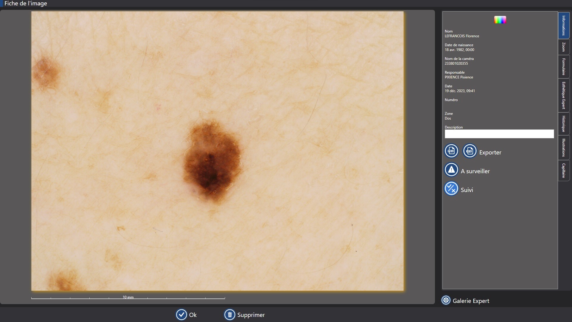 Total Body Mapping : Une imagerie cutanée non invasive