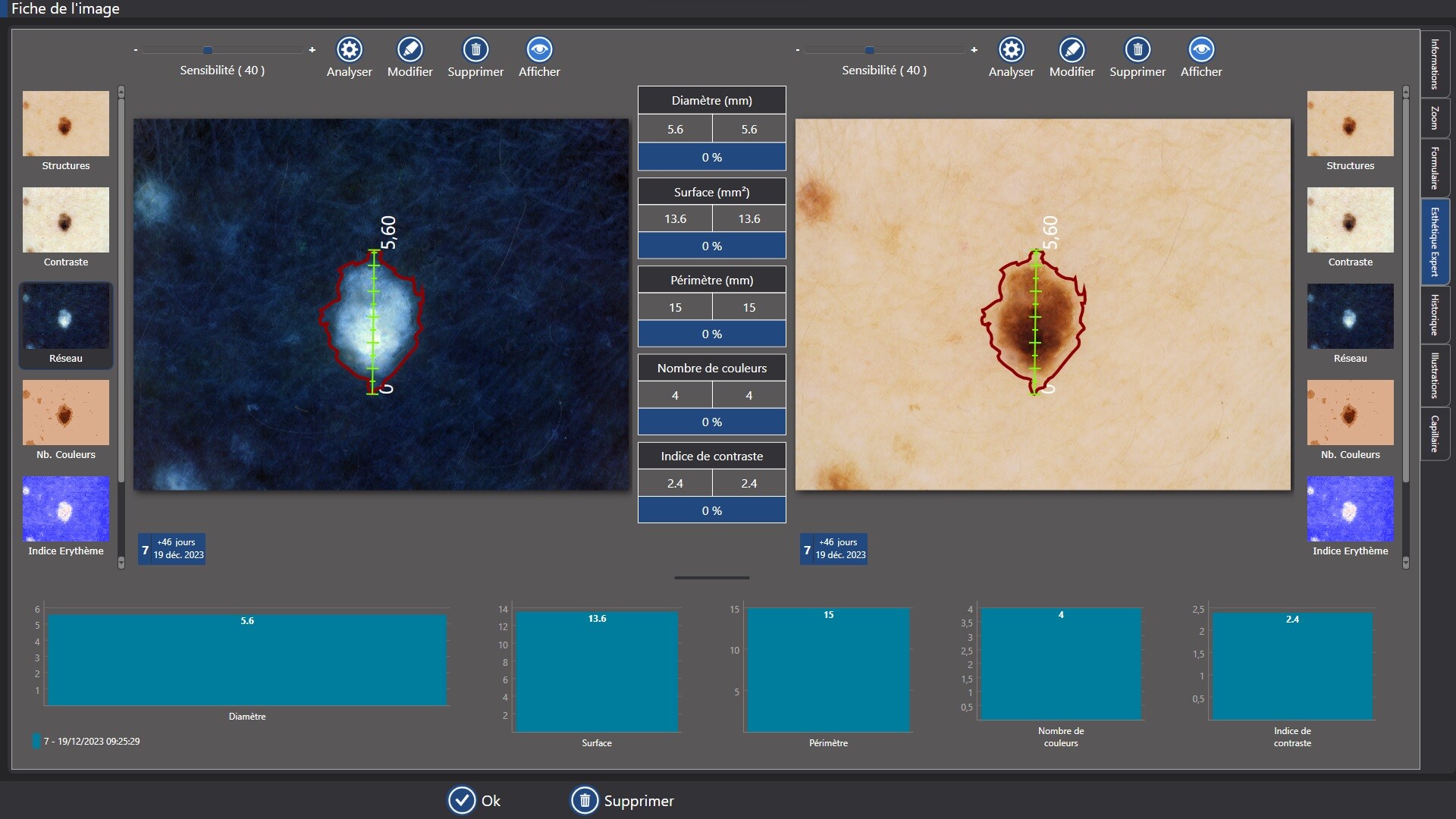 Total Body Mapping : Une imagerie cutanée non invasive